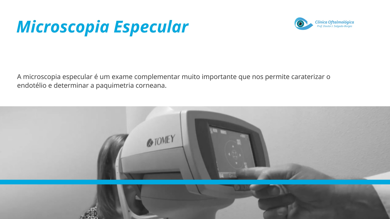 Microscopia Especular (Diagnósticos e Tratamentos) – CLINSBORGES