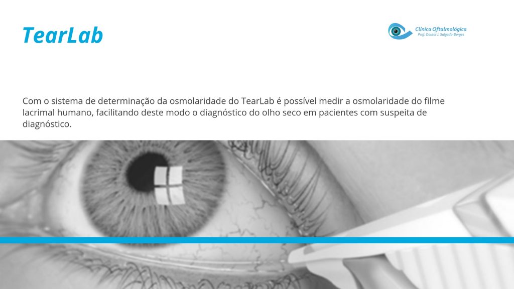 tearlab-bg – Clínica Oftalmológica Porto – Clinsborges